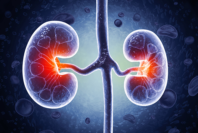 Could Greater Access to Transplantation Reduce the Global Burden of ...